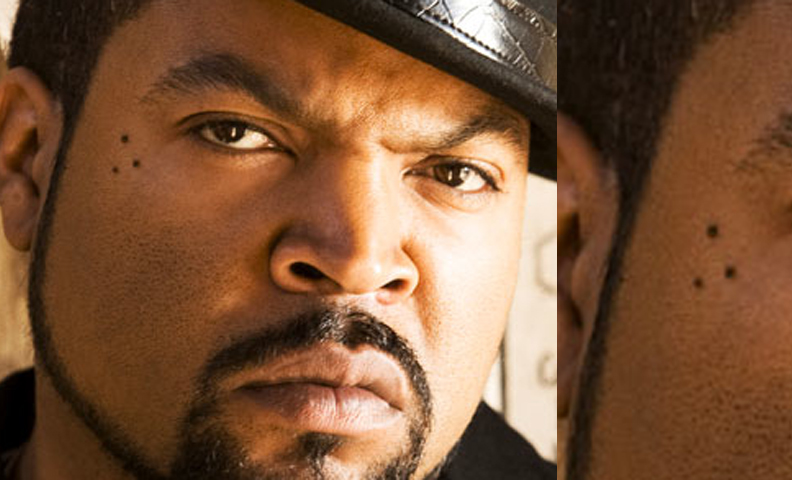 Skinnies Awards | Dermatology in Film | Acne in Movies | Celebrity