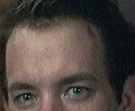 C.M.C - Azaña: Sarcoma de Kaposi